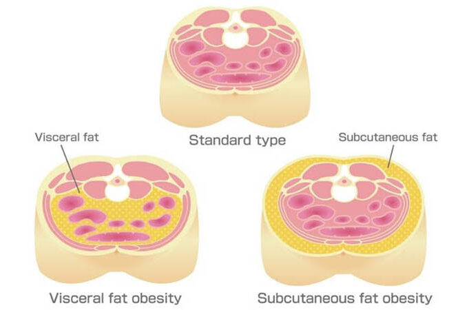 What is Belly Fat or Visceral Fat? How is Visceral Fat Different From ...